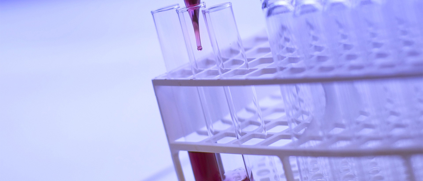 Prise de sang : Quand faire une prise de sang