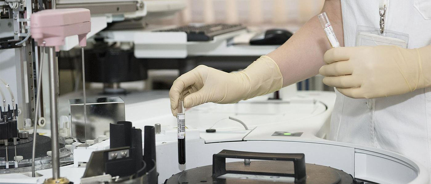 Prise de sang : Quand faire une prise de sang