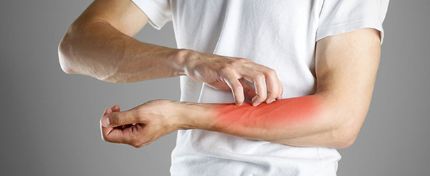 Dermatite atopique cause : quels sont les différents causes