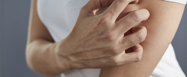 Psoriasis traitement : Quels sont les traitements qui fonctionnent